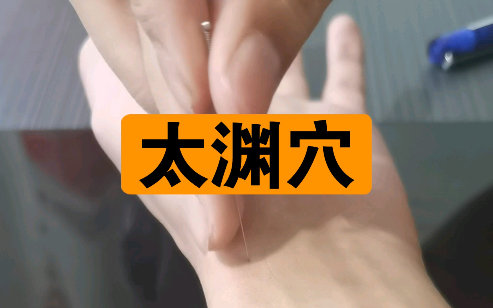 太渊穴,下针示范(跳针)