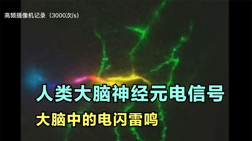 大脑的神经元电信号传导过程,就像是一场电闪雷鸣!