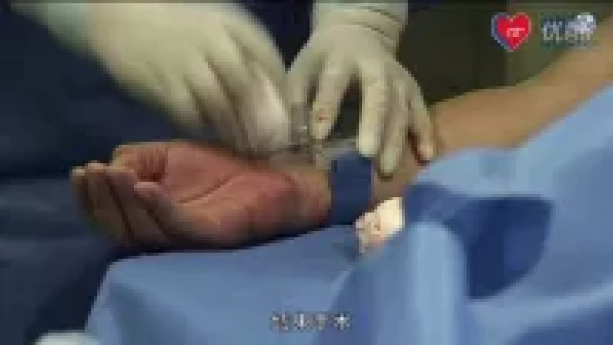 冠状动脉造影技术-下集