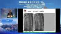 吴华平-法无高下,应机则妙,主动脉弓上分支腔内重建单中心经验回顾