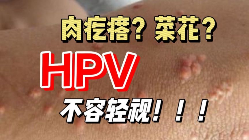 HPV病毒是什么?!