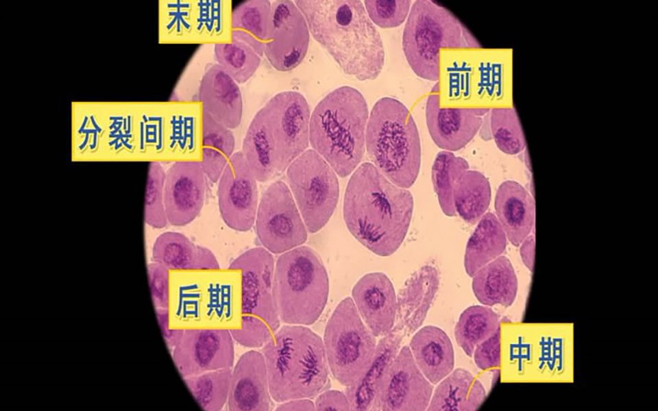 实验:观察根尖分生区组织细胞的有丝分裂