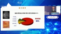 【CACA指南精读巡讲】|江涛教授:指南编写概览——脑胶质瘤整合...
