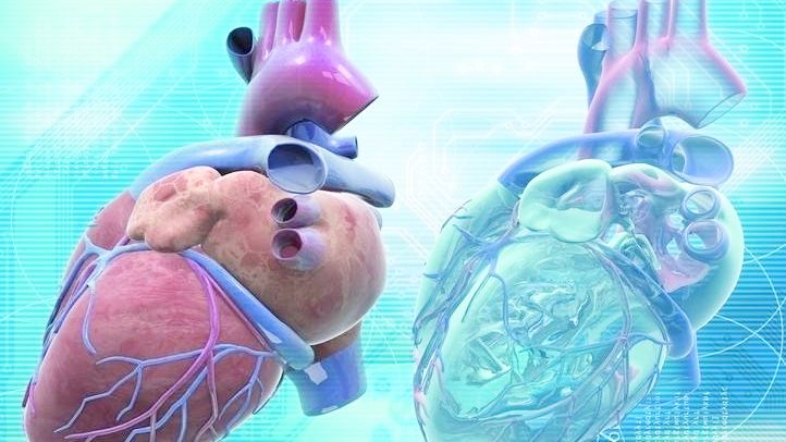 冠状动脉造影过程