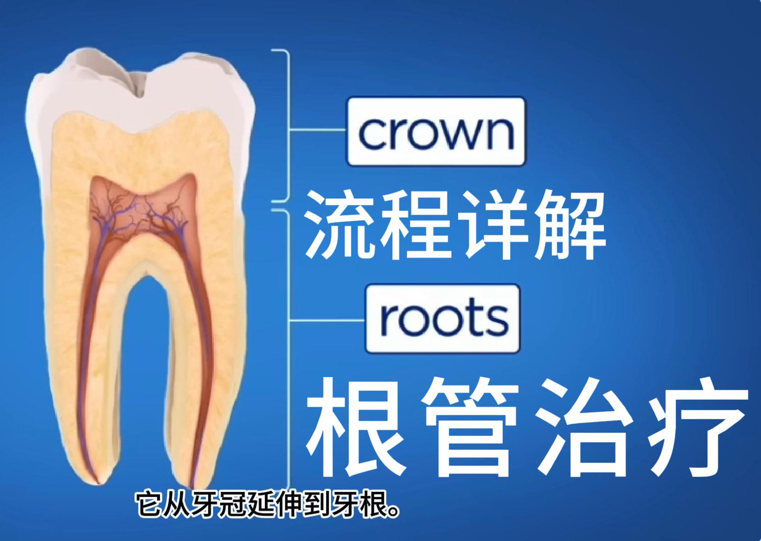 根管治疗的全过程!