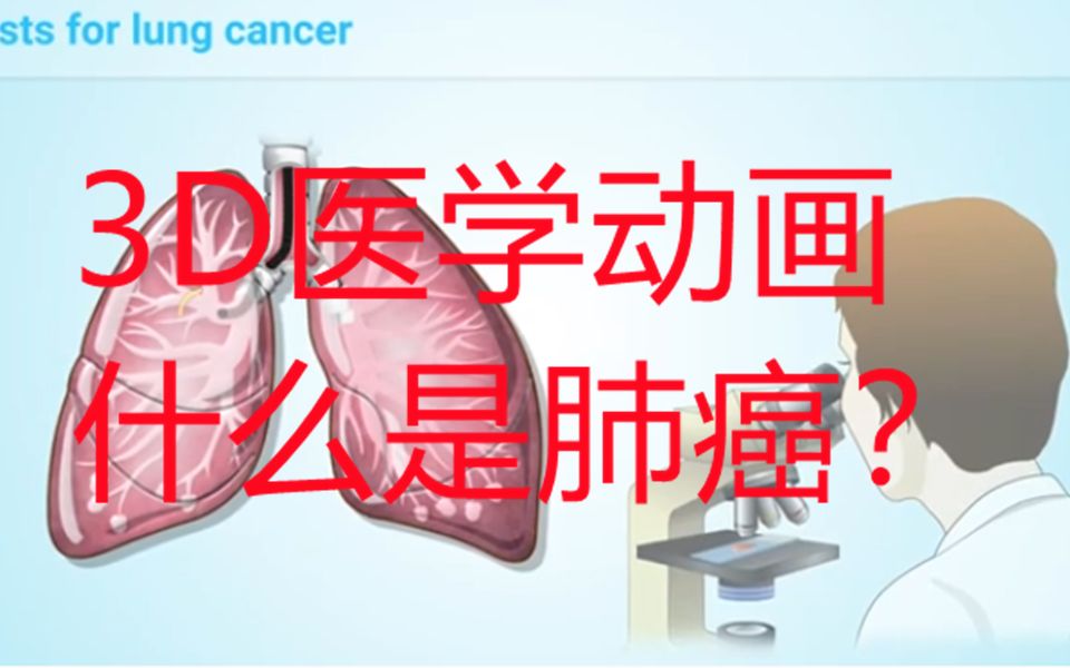 什么是肺癌?-3D医学动画