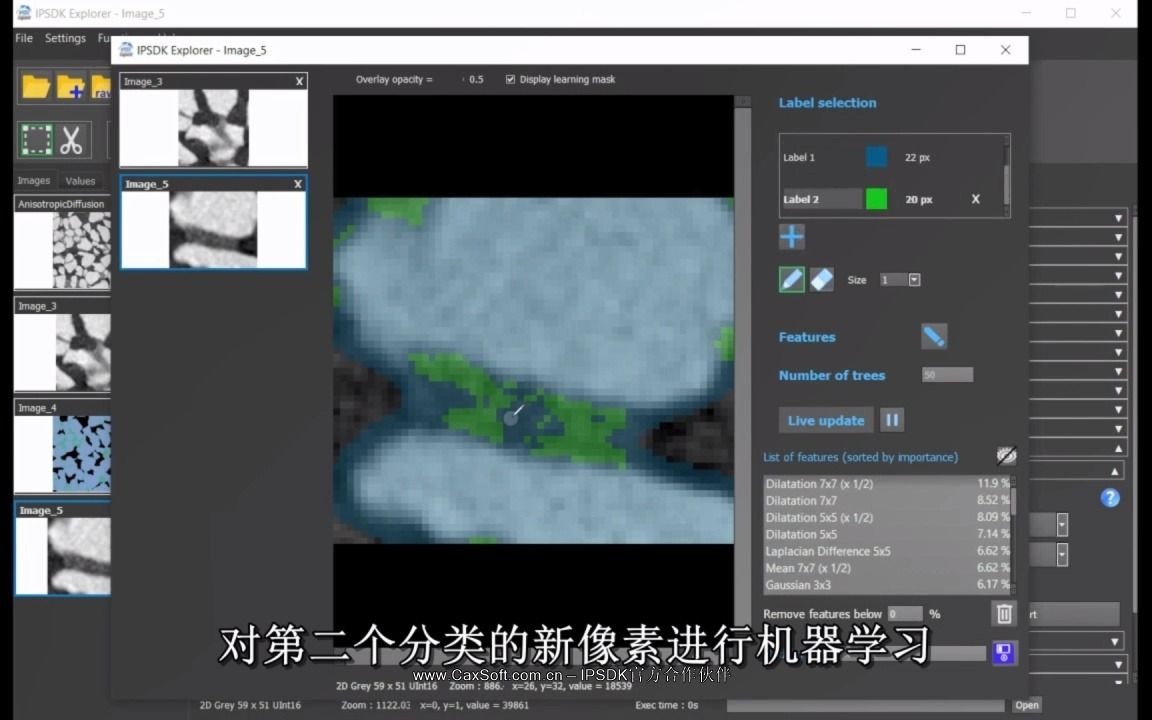 IPSDK三维智能图像处理与分析的机器学习智能分割-楷术科技:CT图像...