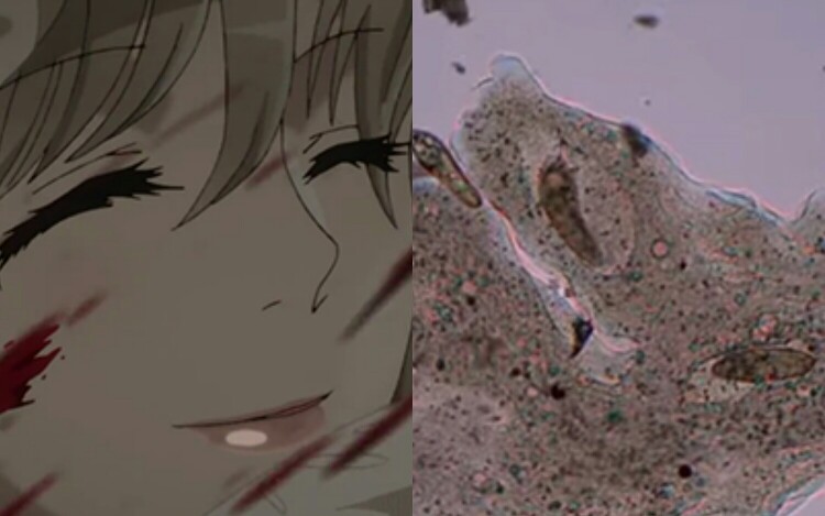 《二次元vs现实》巨噬细胞处理病原体对比。