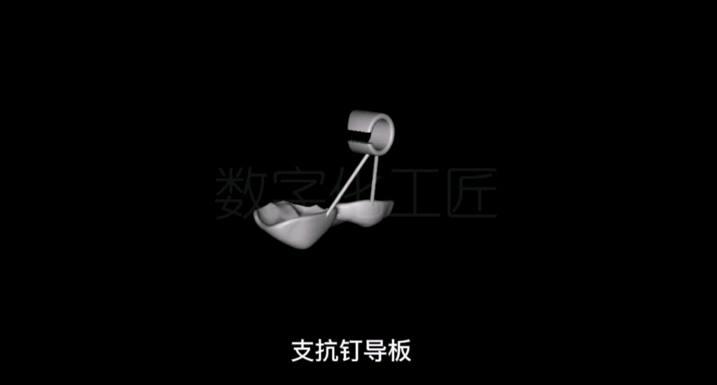 数字化口腔,正畸支抗钉导板制作设计