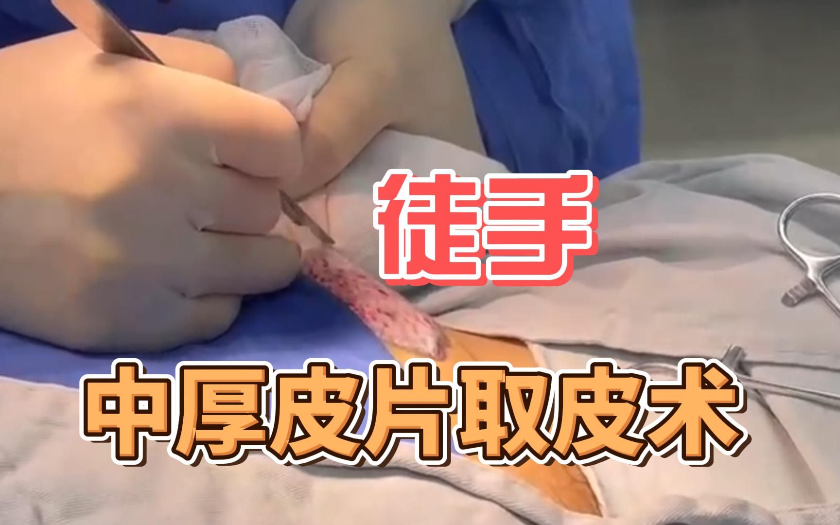 中厚皮片取皮术