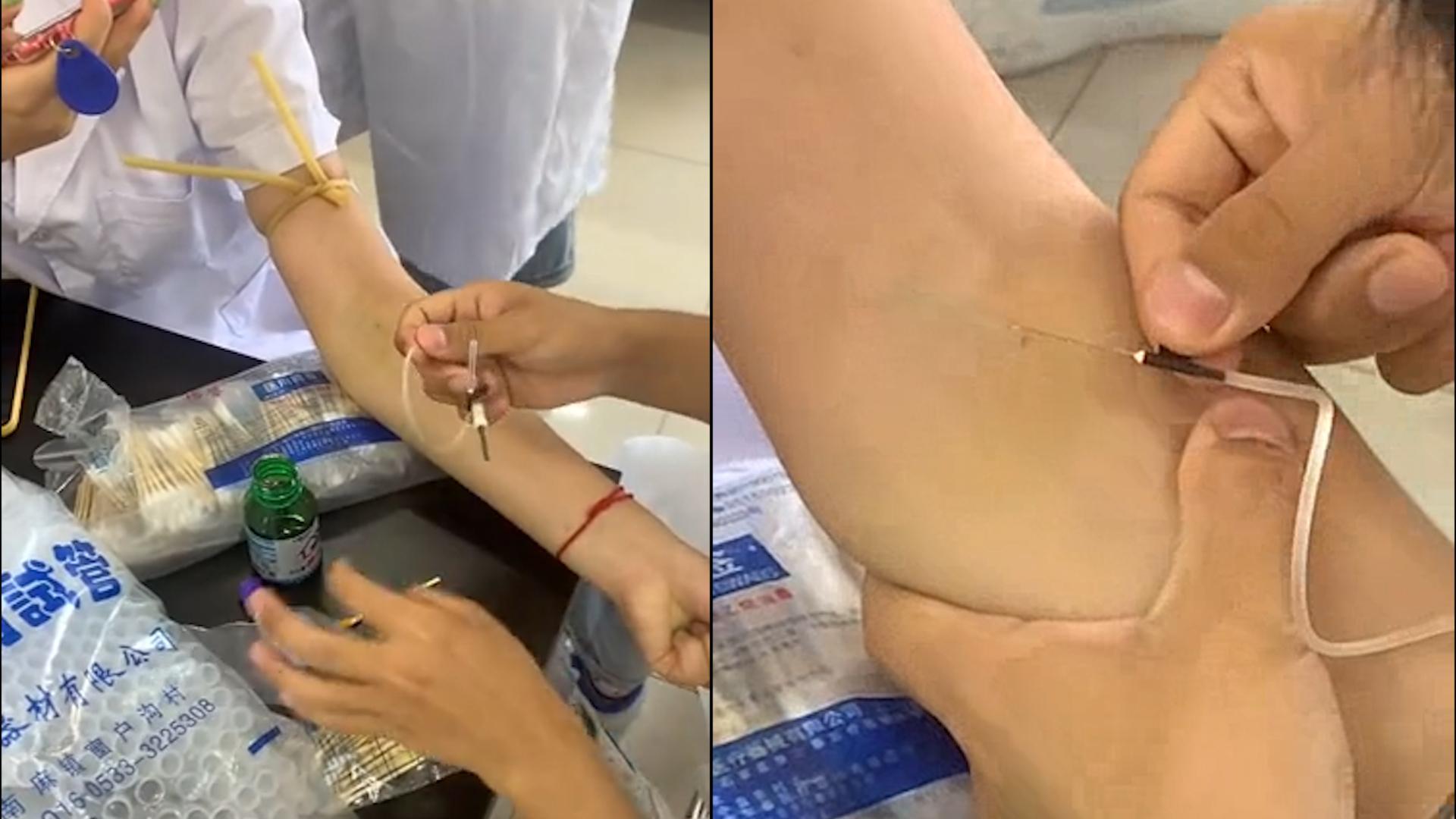 医学生拿同学手臂练采血,刚扎进去针.