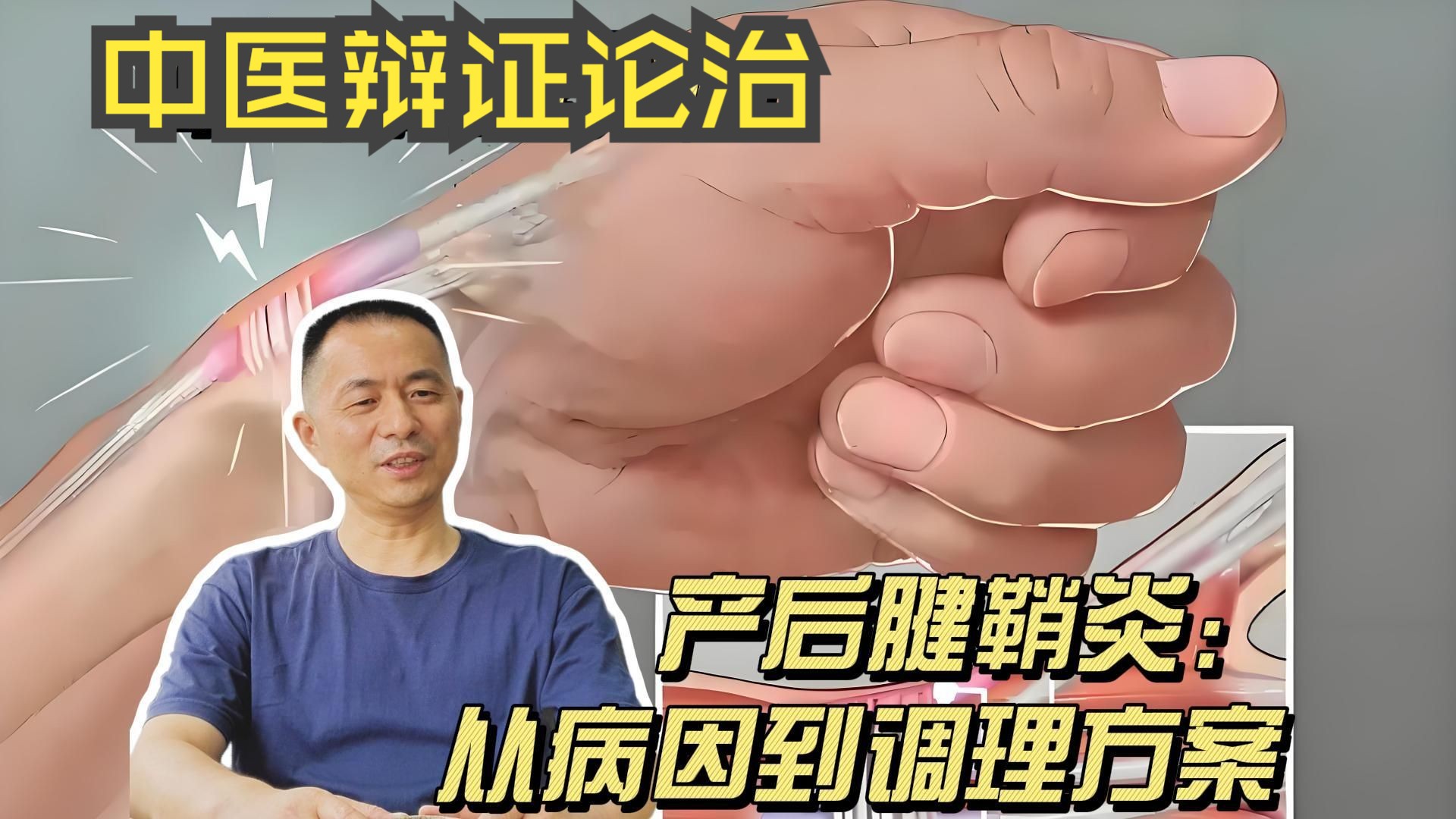 中医辨证论治 | 产后腱鞘炎:从成因到调理方案