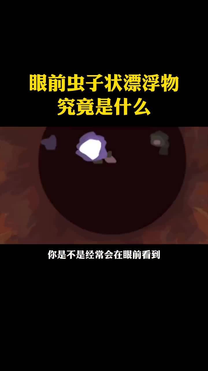 神秘视线解密!那些在你眼前舞动的虫状浮动物体