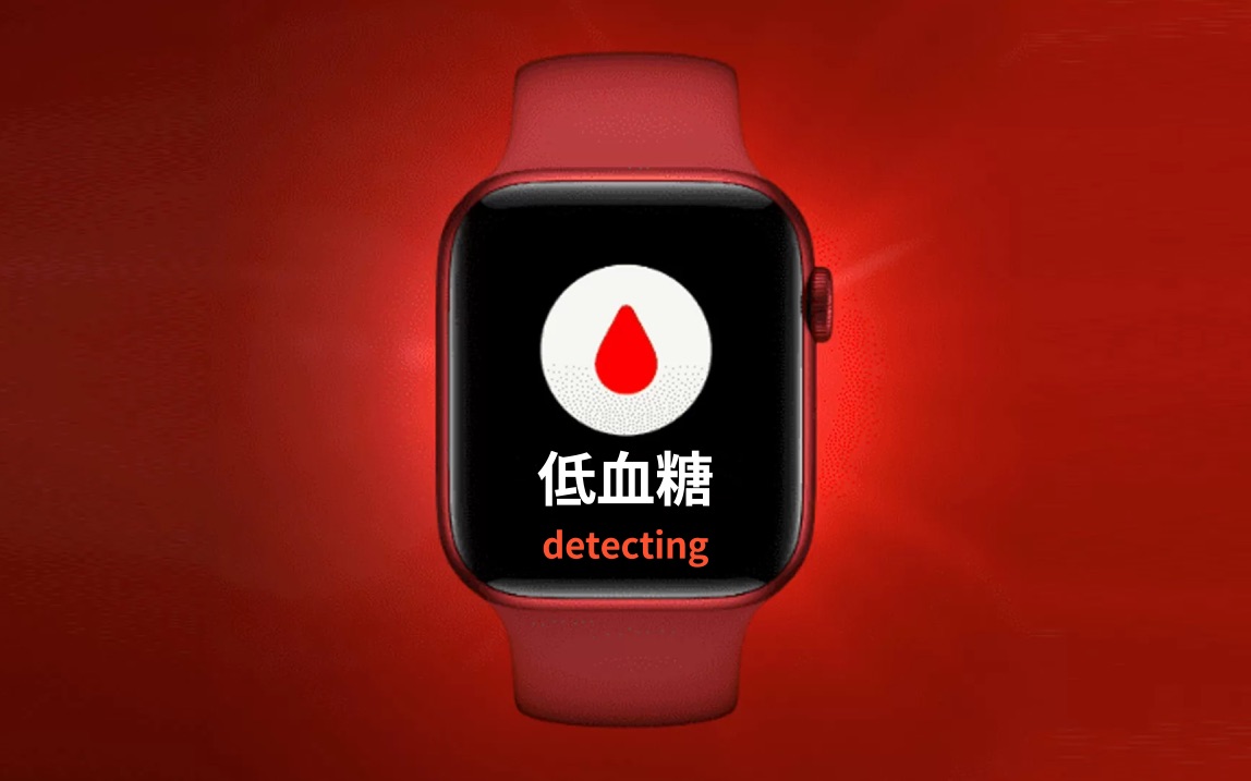 Apple里程碑式的创新:AppleWatch检测血糖进入临床