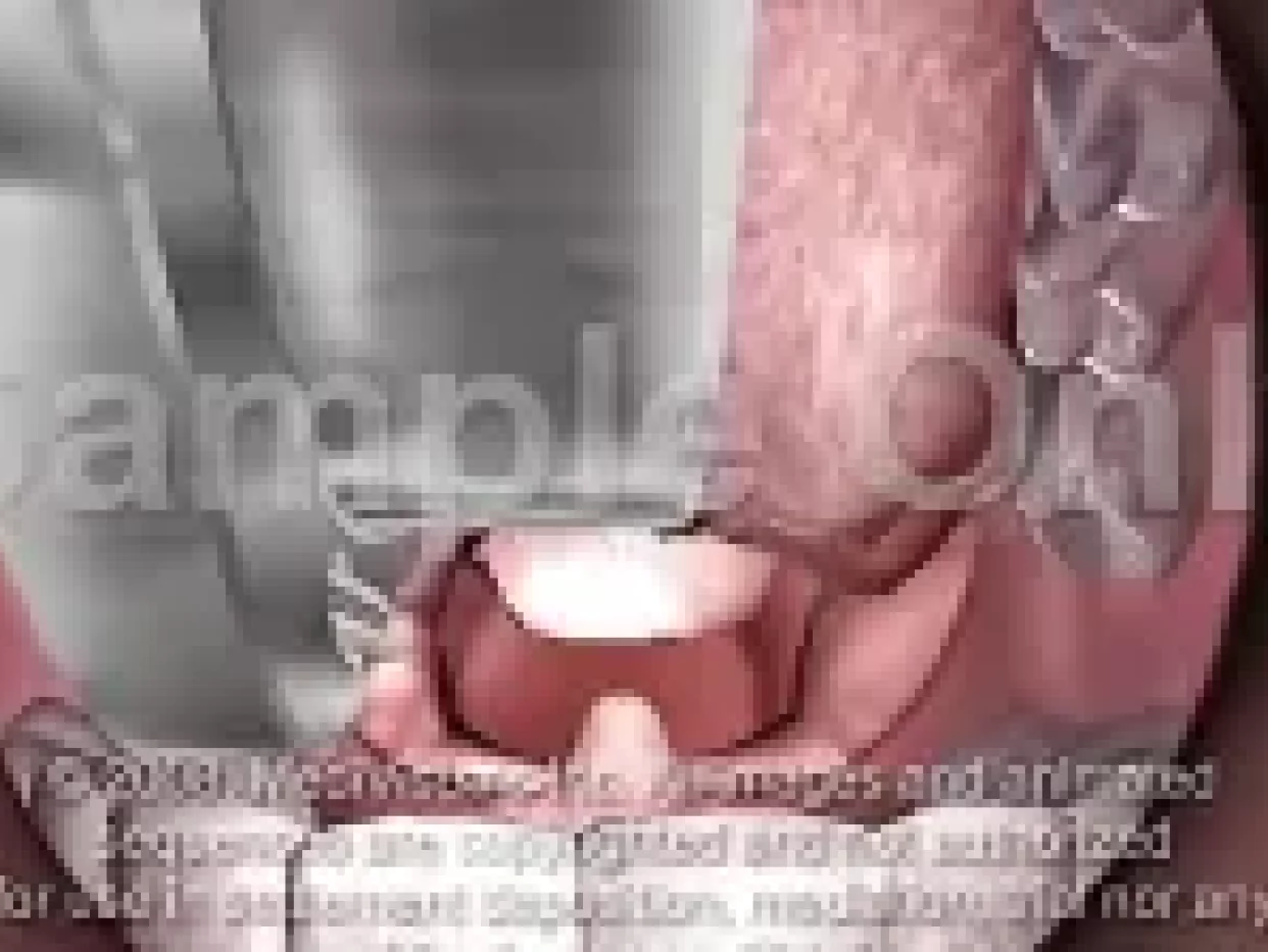 气管插管3D动画(国外)