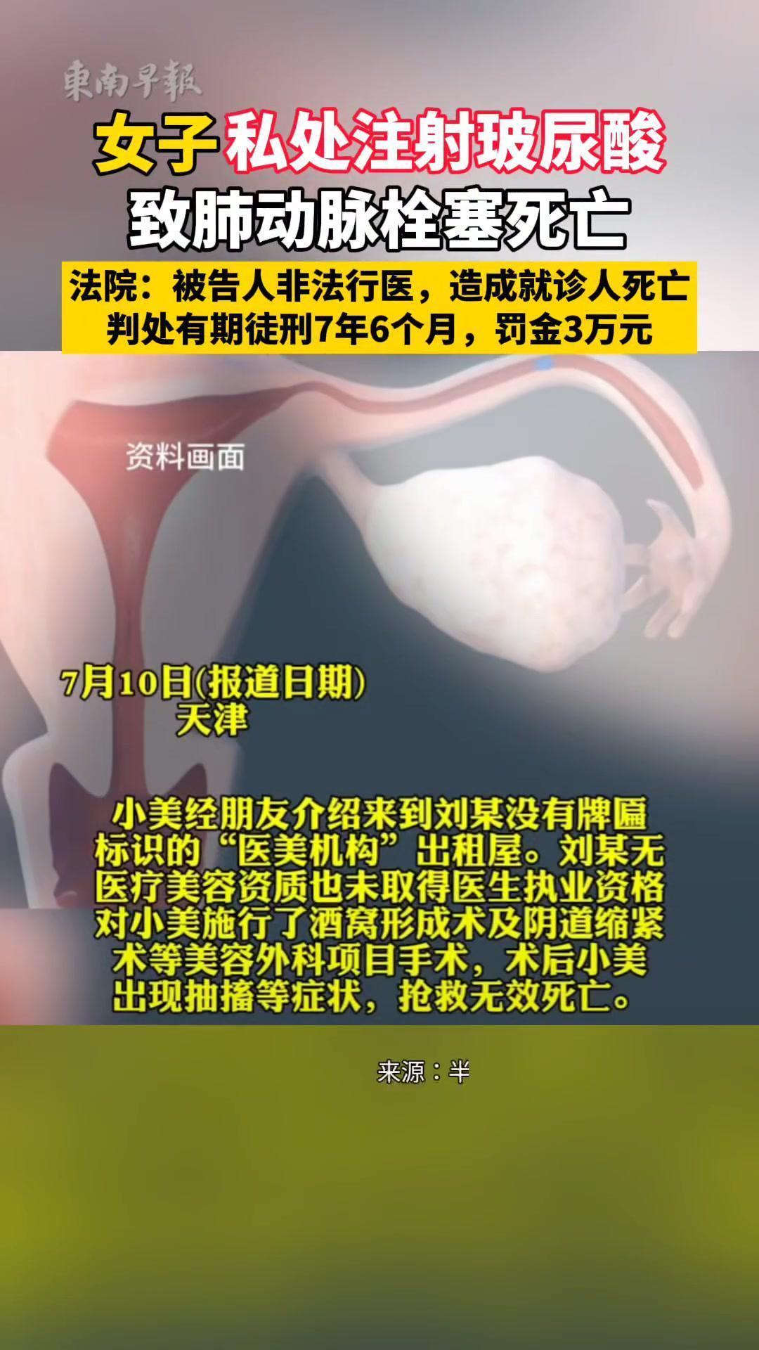 女子私处注射玻尿酸,致肺动脉栓塞死亡