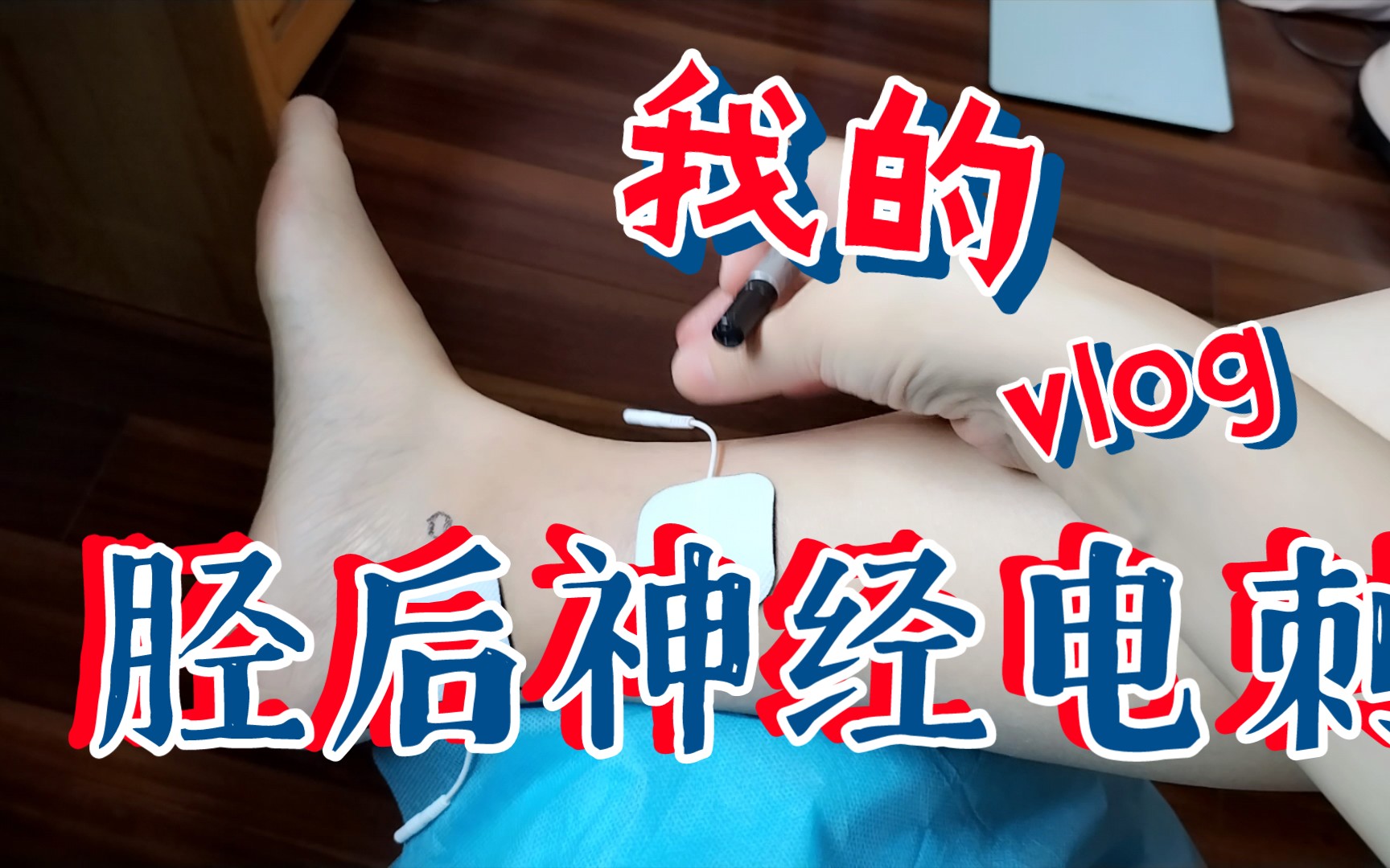 第一节 胫后神经电刺激教程