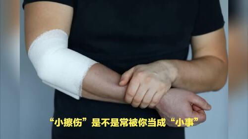 运动擦伤别用酒精!医生警告:错误处理易留疤感染