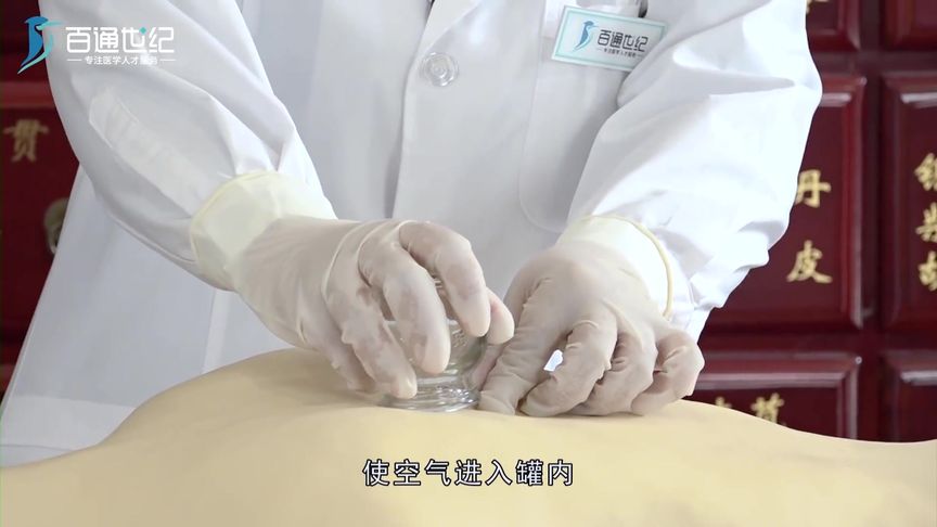 百通世纪中医实践技能之刺络拔罐法