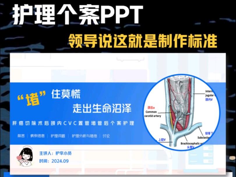 这套PPT就是护理个案的制作标准—CVC置管!