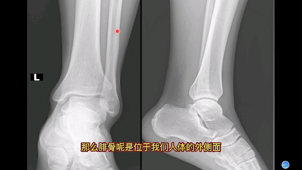 影像基础知识:踝关节骨解剖讲解,简单易懂,3分钟学会