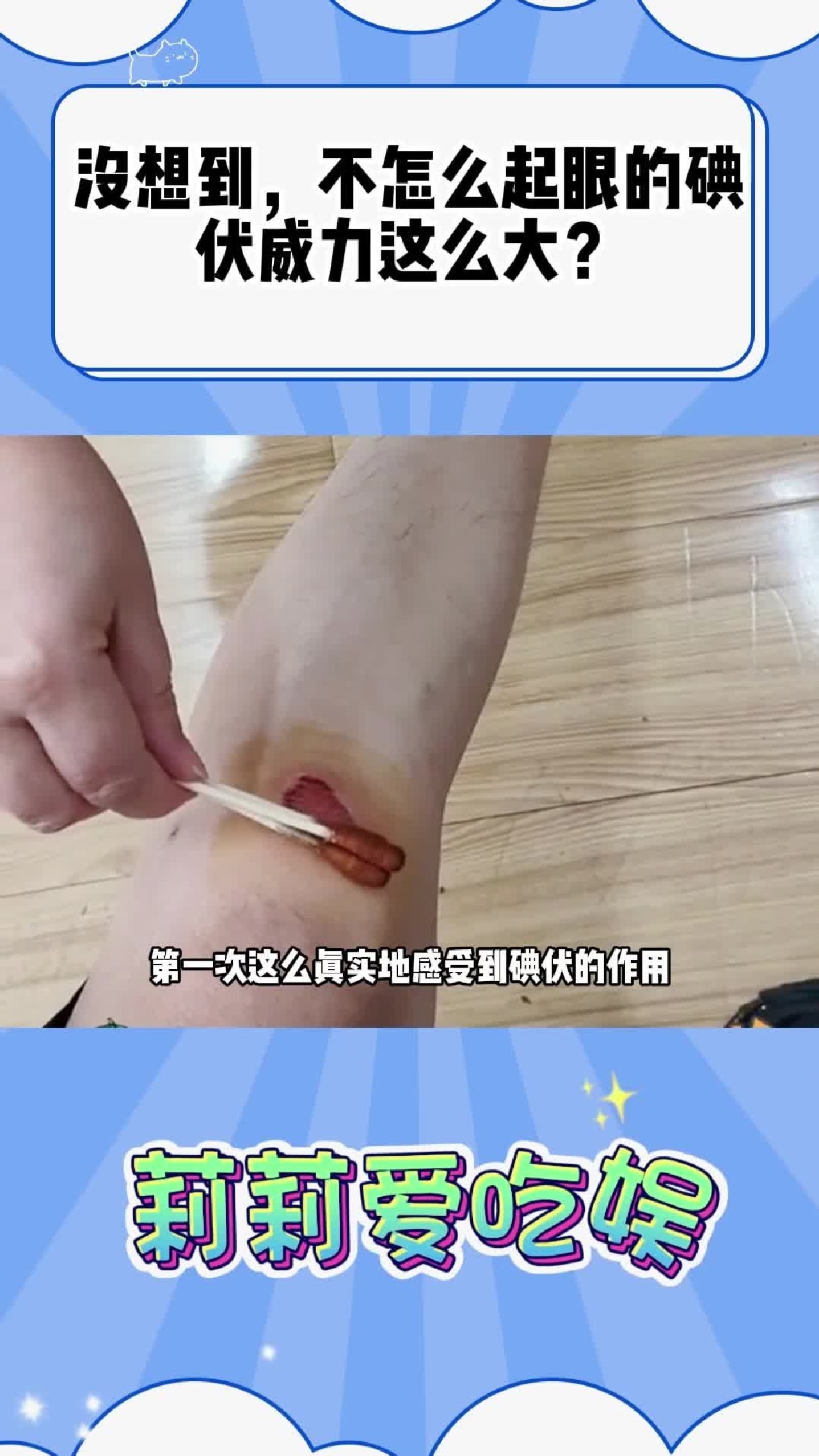 没想到,不怎么起眼的碘伏威力这么大?