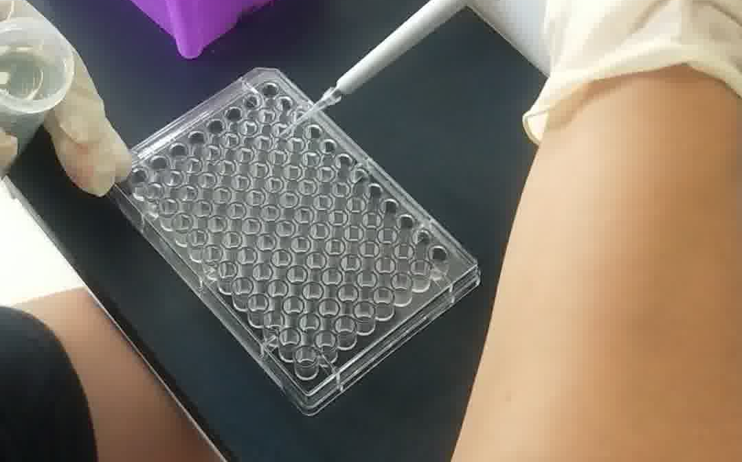 western blot 之制作标准曲线实战清晰版(重庆医科大学/仅供参考)