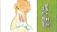 锁骨下静脉穿刺置管术