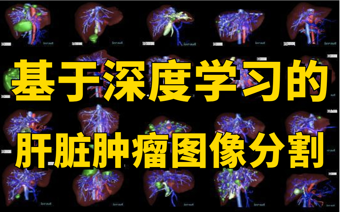 ...代码】医学图像处理实战教程:基于深度学习的肝脏肿瘤图像分割实战,...