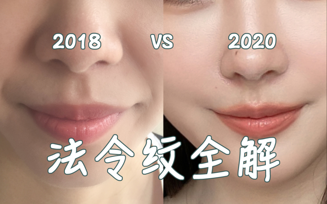 最全各种法令纹改善/预防干货,别再乱花钱做无用功了!【妮可】