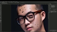 【PS后期教室 】如何修复斑点疤痕痘印瑕疵