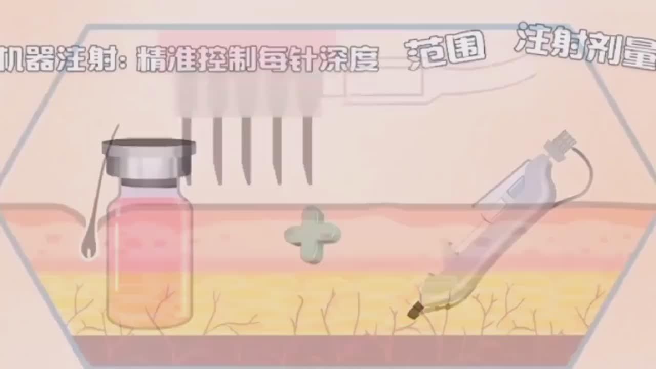 #水光针# 到底是打在皮肤的哪一层,你知道吗? 我们的皮肤分三块大...