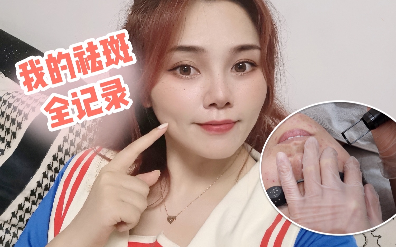 【祛斑vlog】超皮秒祛斑后恢复&护肤流程全记录