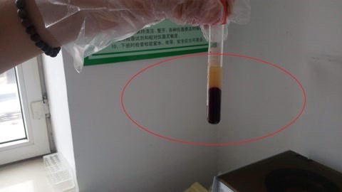 人体不停的在造血,旧的血液被排出体外了吗?说出来你可能不信