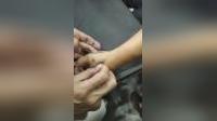 吴士杰无痛一针疗法:上臂后背受限