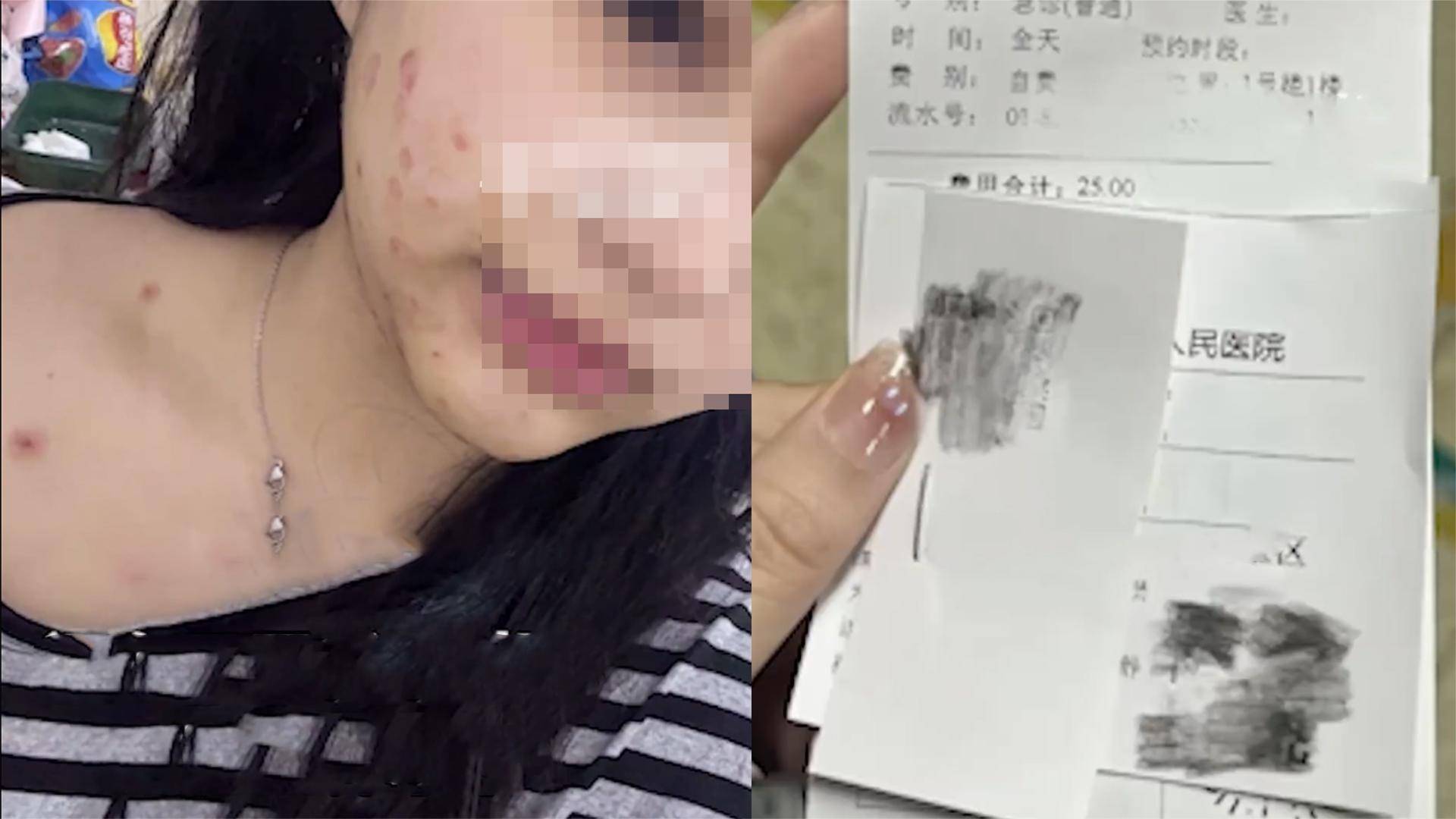 女生800元买猫被传染,全身长猫藓,当事人:商家不愿退赔