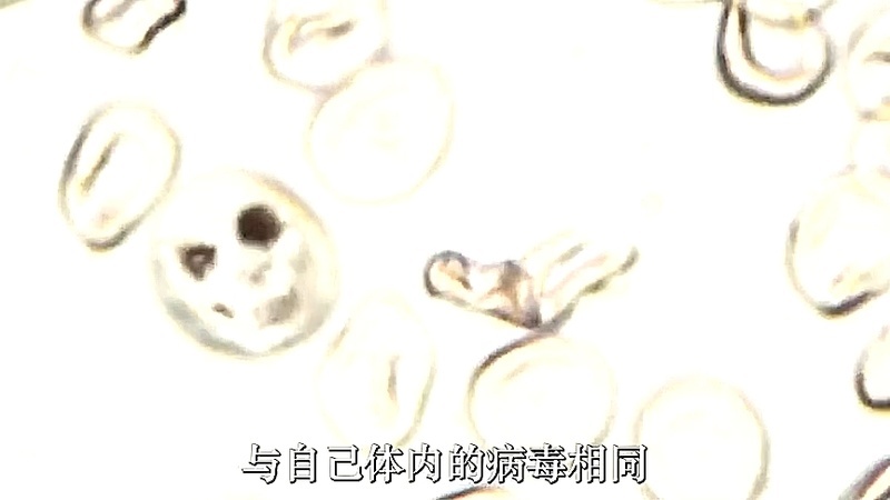 护士下班常去夜店,竟感染了传染性极强的病毒!
