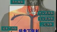 锁骨下静脉穿刺插管_标清
