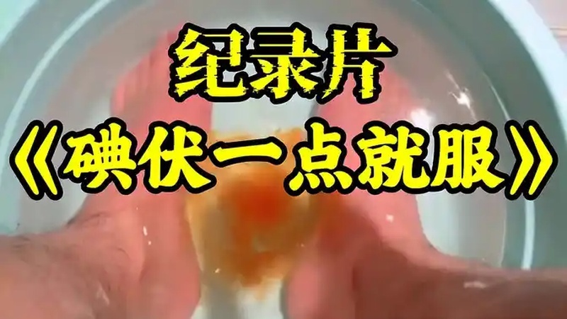 大型纪录片《碘伏一点就服》这也太强了吧