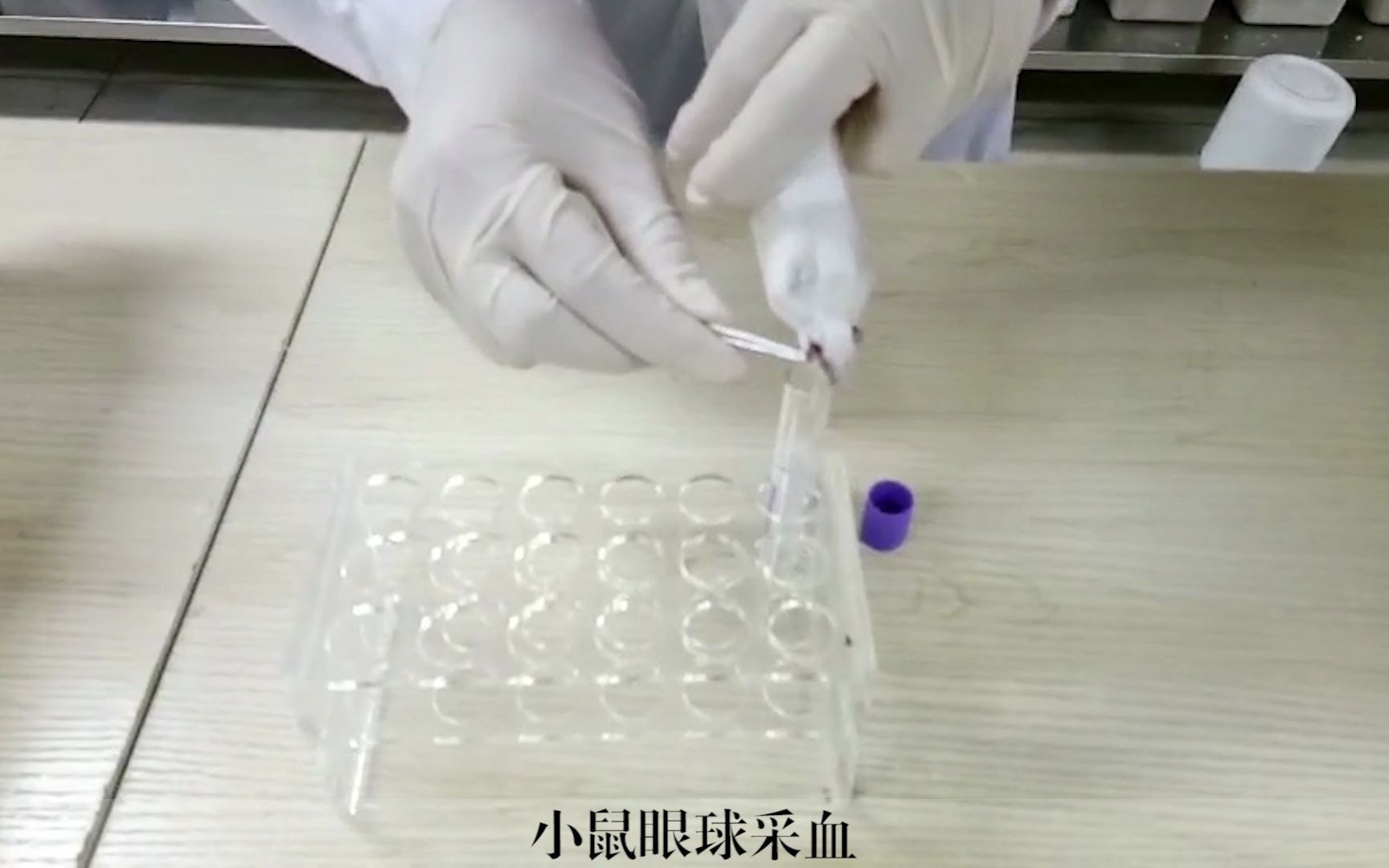 淋巴细胞分离液视频操作
