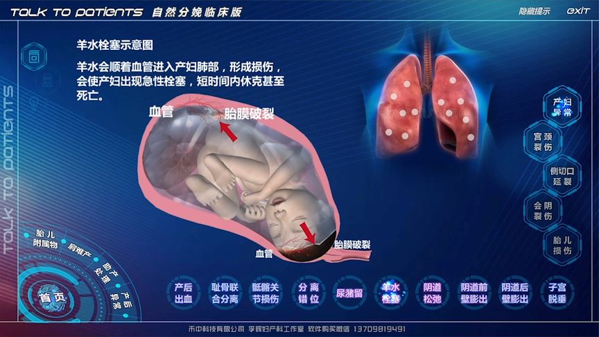 自然分娩中及分娩后都有发生羊水栓塞的可能,什么是羊水栓塞?
