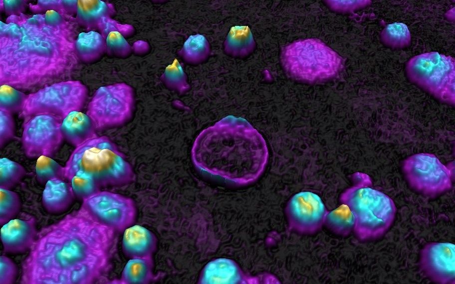 完整展现Cama-1乳腺癌细胞调往过程 HoloMonitor M4镜头下的细胞世界