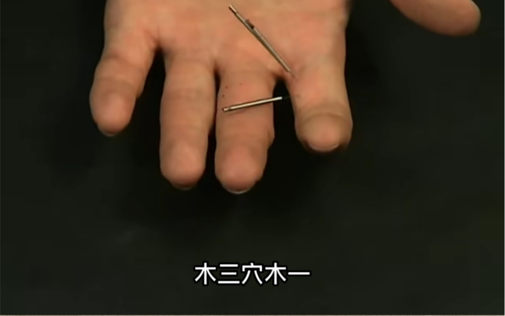 中医人体穴位分布及作用:《木穴》