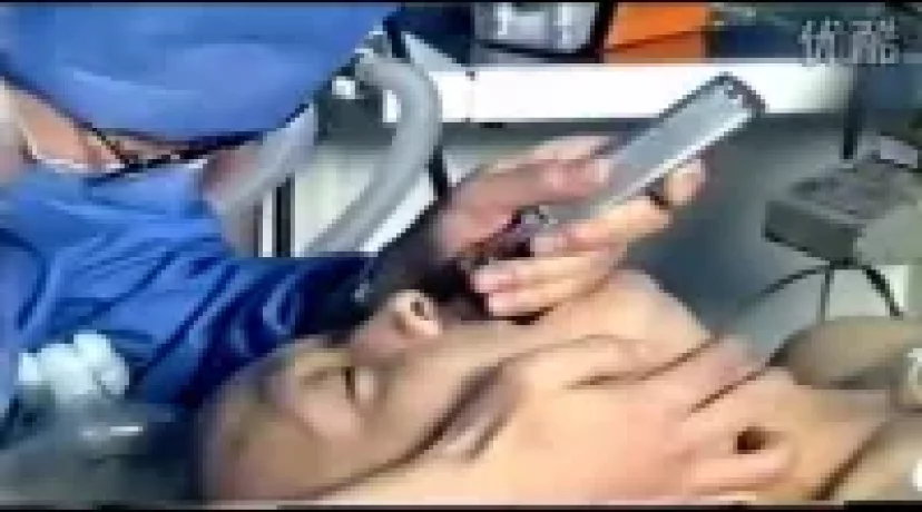 气管插管教程(国内)