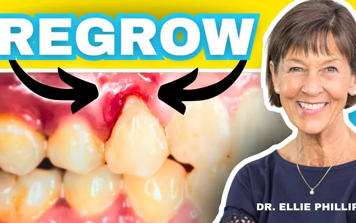如何使萎缩的牙龈再生(在家修复牙龈萎缩),埃莉·菲利普斯博士