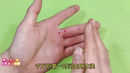 手扎流血正确处理方式,别再错了