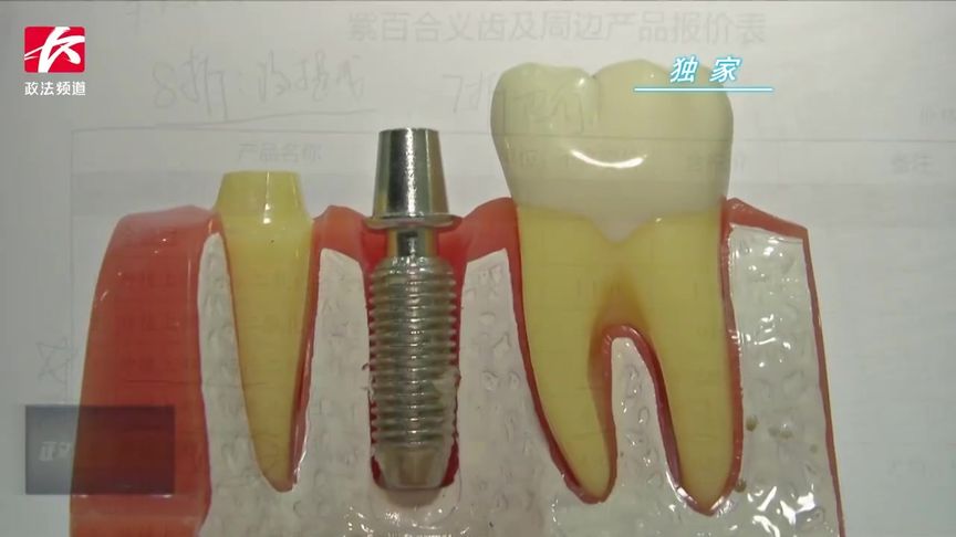 一颗全瓷牙成本仅200元却被卖到上万元!男子植牙被吓傻:换不起
