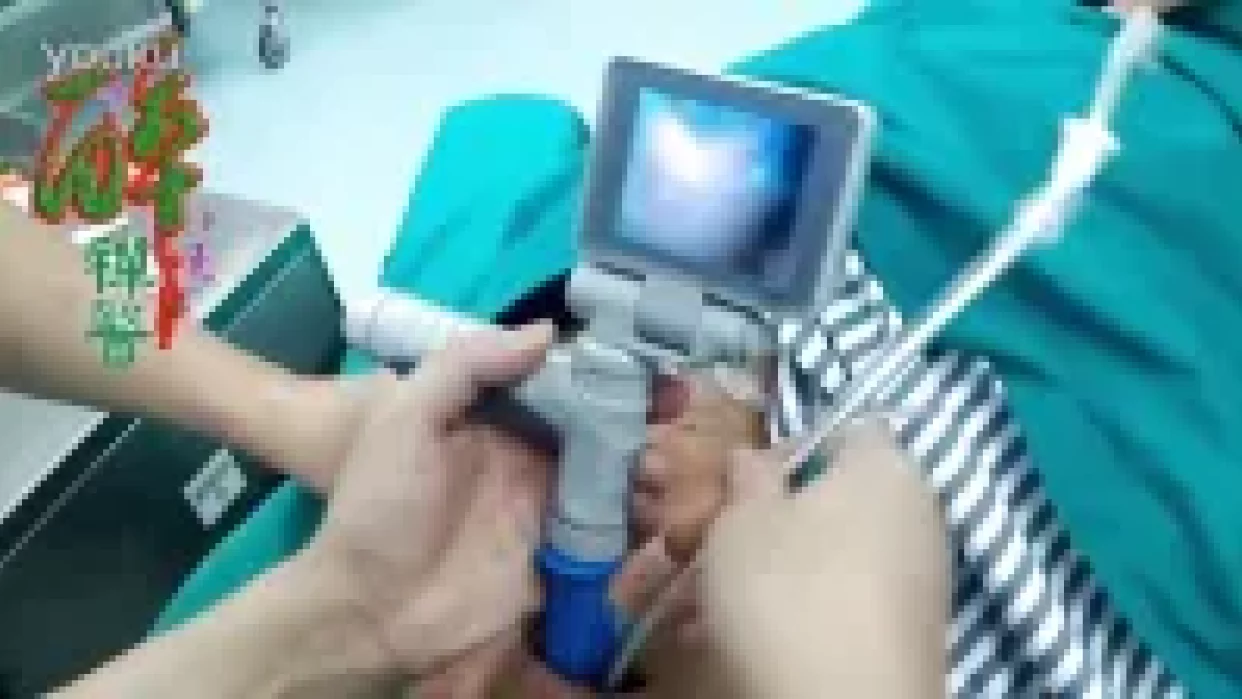 HC视频喉镜气管插管