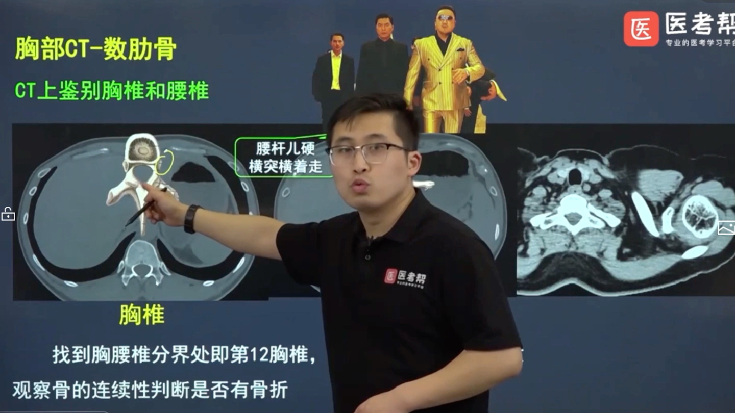 胸部CT(1)数肋骨