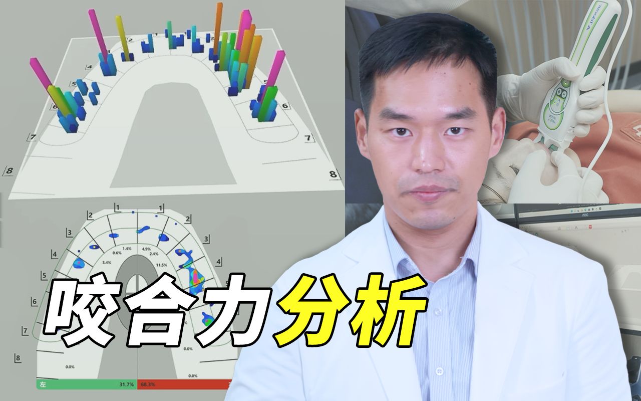 关节不适,咬合不好是心理问题?数字化设备让内在问题一览无余